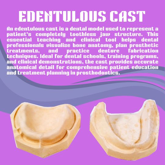 Edentulous Cast – Barroga Dental Supply